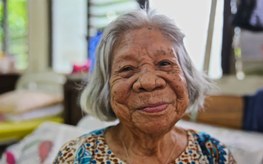 Novartis Foundation joins Global Partnership for Zero Leprosy | Novartis