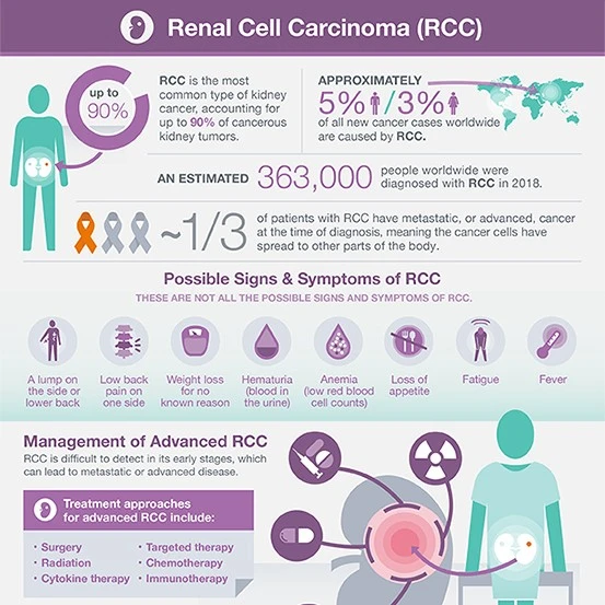 Renal Cell Carcinoma Infographic | Novartis
