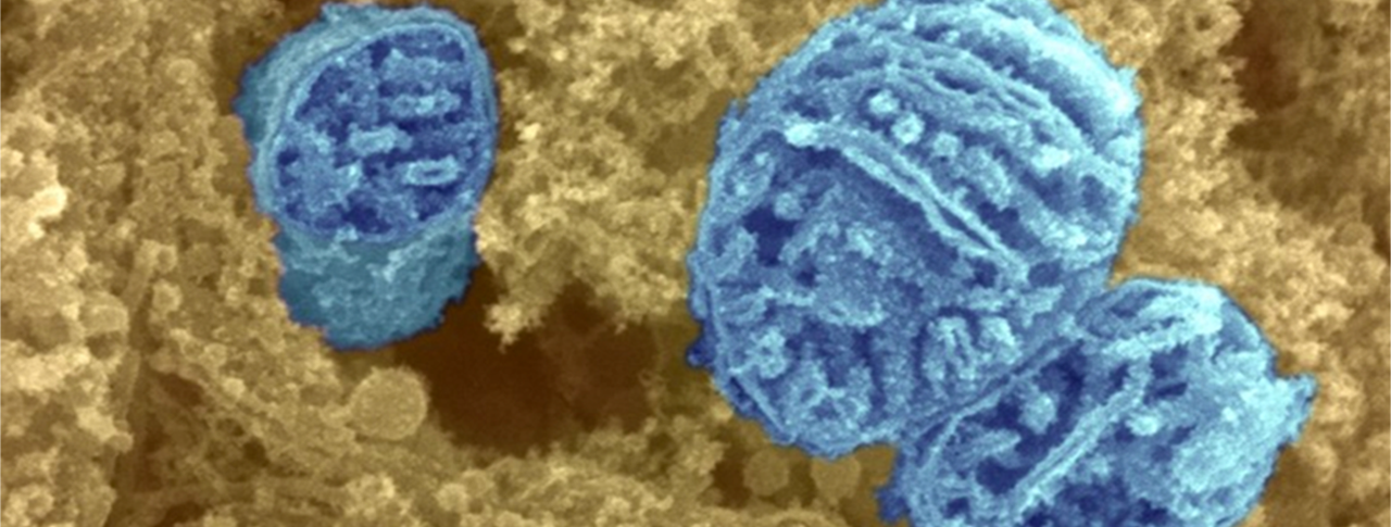 Stopping free radicals at their source | Novartis